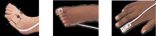 SpO2 monitoring in the highly dependent or critically ill infant or child