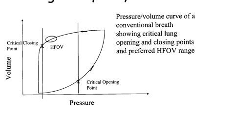 High Frequency Oscillatory Ventilation (HFOV) : a guide to the use of ...
