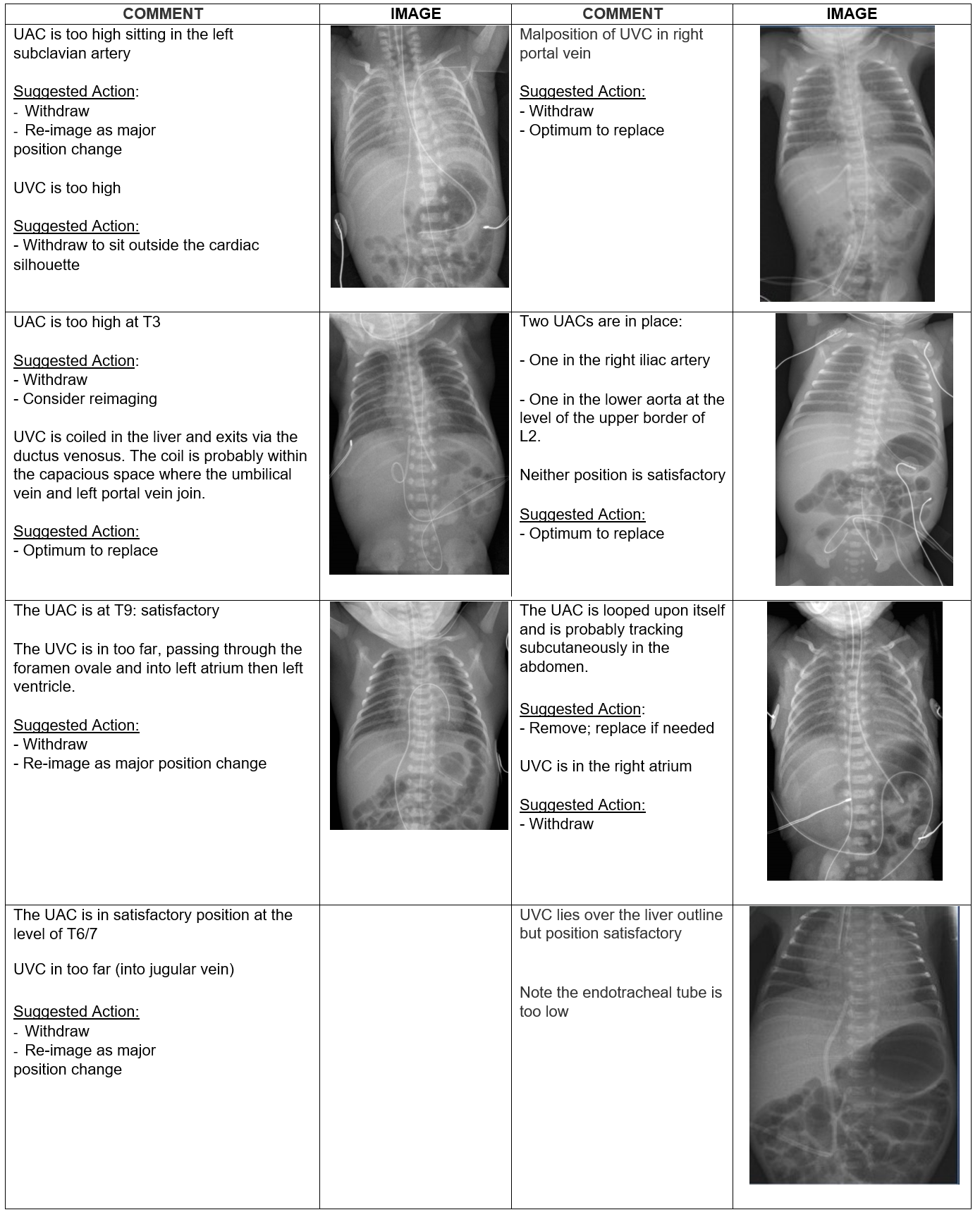 Guide Catheter Position At Connor Alexander Blog